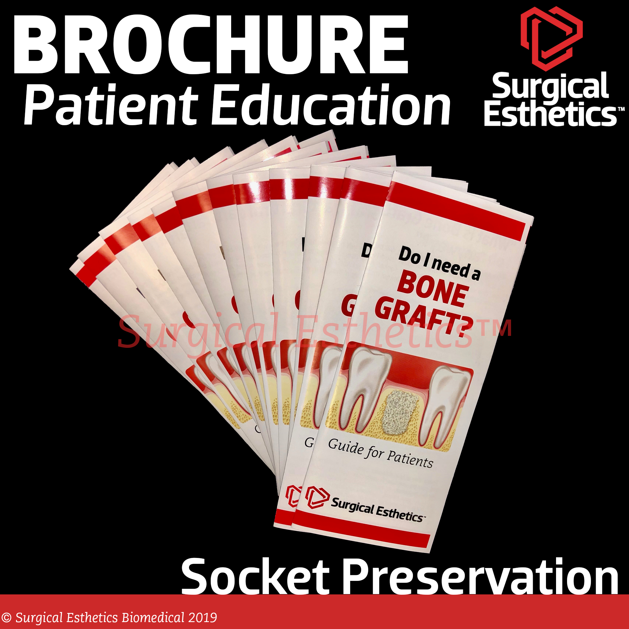 Patient Brochures (pack of 50) - Socket Grafting – Surgical Esthetics ...